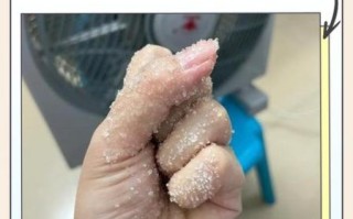 辣椒辣手怎么快速止痛_切辣椒后手很辣怎么办