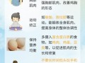 轻微鸡胸怎么自己矫正_鸡胸自我矫正动作