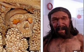 莲蓬乳病是什么_莲蓬乳病会传染吗