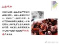 毛蚶甲肝事件_如何预防