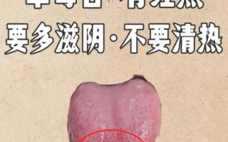 草莓舌头是什么病_草莓舌头怎么治疗