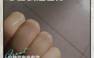 辣椒辣手怎么办_最有效的止痛方法