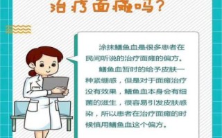 黄鳝血治疗面瘫的步骤_黄鳝血治面瘫有效吗