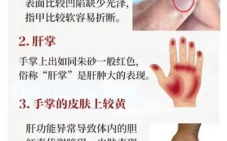 肝不好的人脚有什么症状_如何通过脚部判断肝脏问题