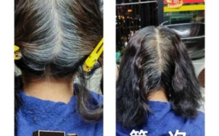 生发乌发秘方真的有用吗_白发变黑发最简单的方法