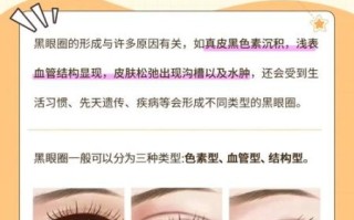 黑眼圈怎么消除最快_去黑眼圈最有效的方法