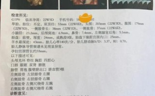 大排畸检查多少钱_大排畸价格是多少