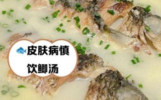 鲫鱼汤什么人不能喝_鲫鱼汤禁忌人群有哪些