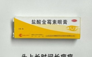脱发严重怎么治疗才有效_脱发严重用什么药最好