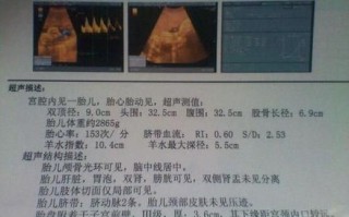 b超有两点基本是男孩_准确率有多高