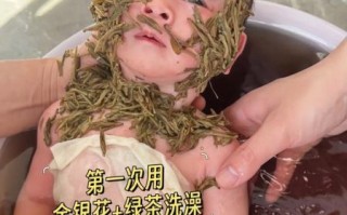 蚕豆病可以吃金银花吗_蚕豆病金银花禁忌 蚕豆病可以吃金银花吗_蚕豆病金银花禁忌