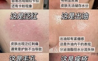 皮肤干燥起皮怎么办_身体干痒脱屑怎么快速缓解