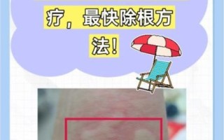 大蒜治荨麻疹真的有用吗_怎么用大蒜快速止痒