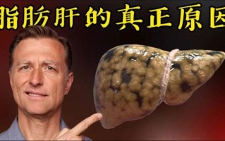 脂肪肝这个病严重吗_脂肪肝多久会恶化