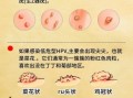 菜花状疣体是不是已经很严重了_菜花状疣体怎么治疗