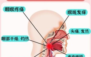 喉咙有异物感是怎么回事_怎么快速缓解