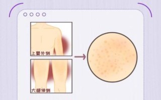 小鸡上长疙瘩了怎么回事_小鸡皮肤长疙瘩怎么办