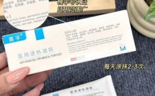 荨麻疹不管它会自愈吗_荨麻疹不治疗多久能好