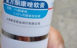 鹅掌风会传染吗_鹅掌风用什么药膏好