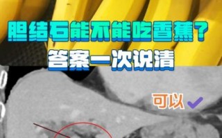 胆结石吃什么水果好_胆结石不能吃什么水果