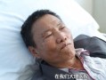 肝硬化晚期死前6个月征兆_还能活多久