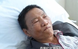 肝硬化晚期死前6个月征兆_还能活多久