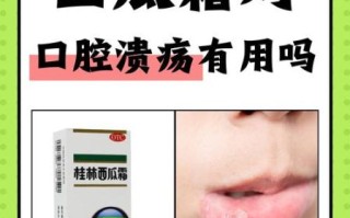 西瓜霜治疗口腔溃疡的原理_西瓜霜为什么见效快