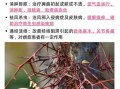 皂角刺的功效与作用_皂角刺主治什么病