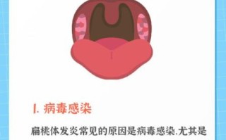扁桃体发炎一般几天好_扁桃体发炎多久能好