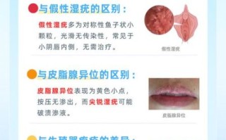 女性下面长菜花是什么原因_会传染吗