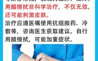 盐水能治好荨麻疹吗_盐水止痒多久见效