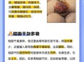 干桂圆吃多了会怎样_上火还是补血