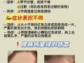 怎么判断是不是湿疹_湿疹初期症状有哪些