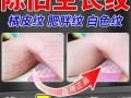 橘皮纹怎么消除_橘皮纹是什么原因