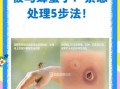 马蜂图片怎么区分种类_被马蜂蛰了怎么办