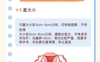 巧克力囊肿会影响怀孕吗_巧克力囊肿怎么治疗最好