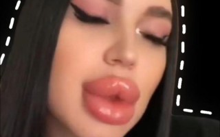 香肠嘴图片女丑_香肠嘴女生怎么改善