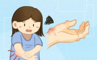 痛风发作怎么快速止痛_痛风克星一分钟见效是真的吗