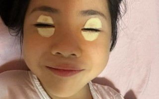 土豆片去黑眼圈的正确方法_土豆片敷眼多久见效