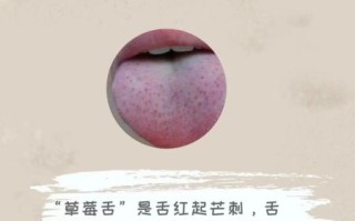 草莓舌头图片_草莓舌头是什么原因