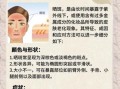 祛斑效果最好的方法是什么_祛斑最有效的办法有哪些