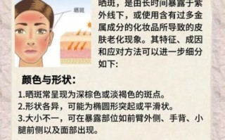 祛斑效果最好的方法是什么_祛斑最有效的办法有哪些