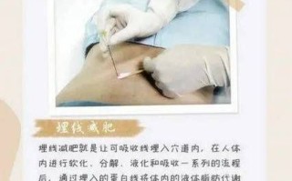经络埋线减肥多久见效_经络埋线减肥安全吗