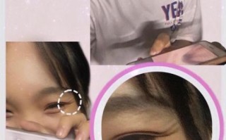 长鱼尾纹了怎么办_鱼尾纹怎么消除