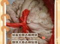 洗猪大肠最好的方法_猪大肠怎么洗才干净无异味