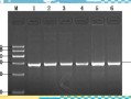 琼脂糖凝胶电泳marker怎么选_marker条带大小怎么看