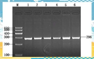 琼脂糖凝胶电泳marker怎么选_marker条带大小怎么看