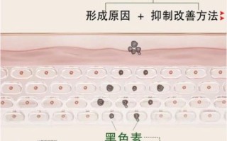 色素沉淀怎么消除_皮肤色素沉淀怎么淡化