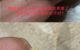 淡菜怎么清洗_淡菜清洗的正确方法