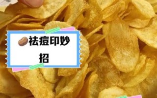 土豆敷脸祛斑的正确方法_土豆片敷脸多久能祛斑